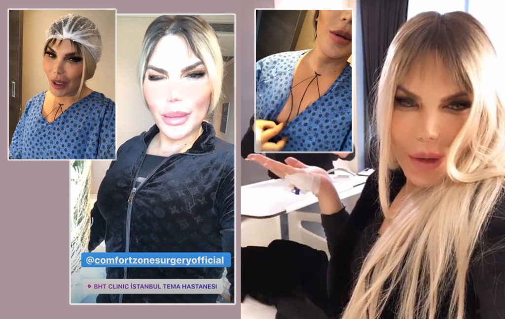 Rodrigo Alves, il Ken umano diventa Barbie: la foto della trasformazione